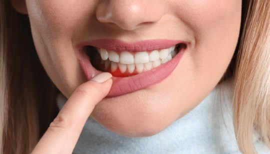 When a Dental Abscess Bursts - [What To Do]