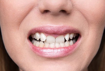 Do Genetics Influence Oral Health? - [Must Read 2]